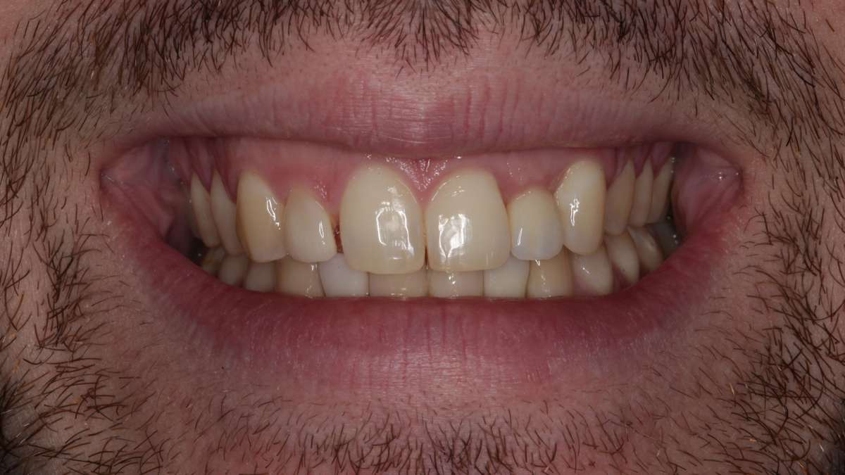 Periodontics and Dental Implants in Manhattan | Perio NYC